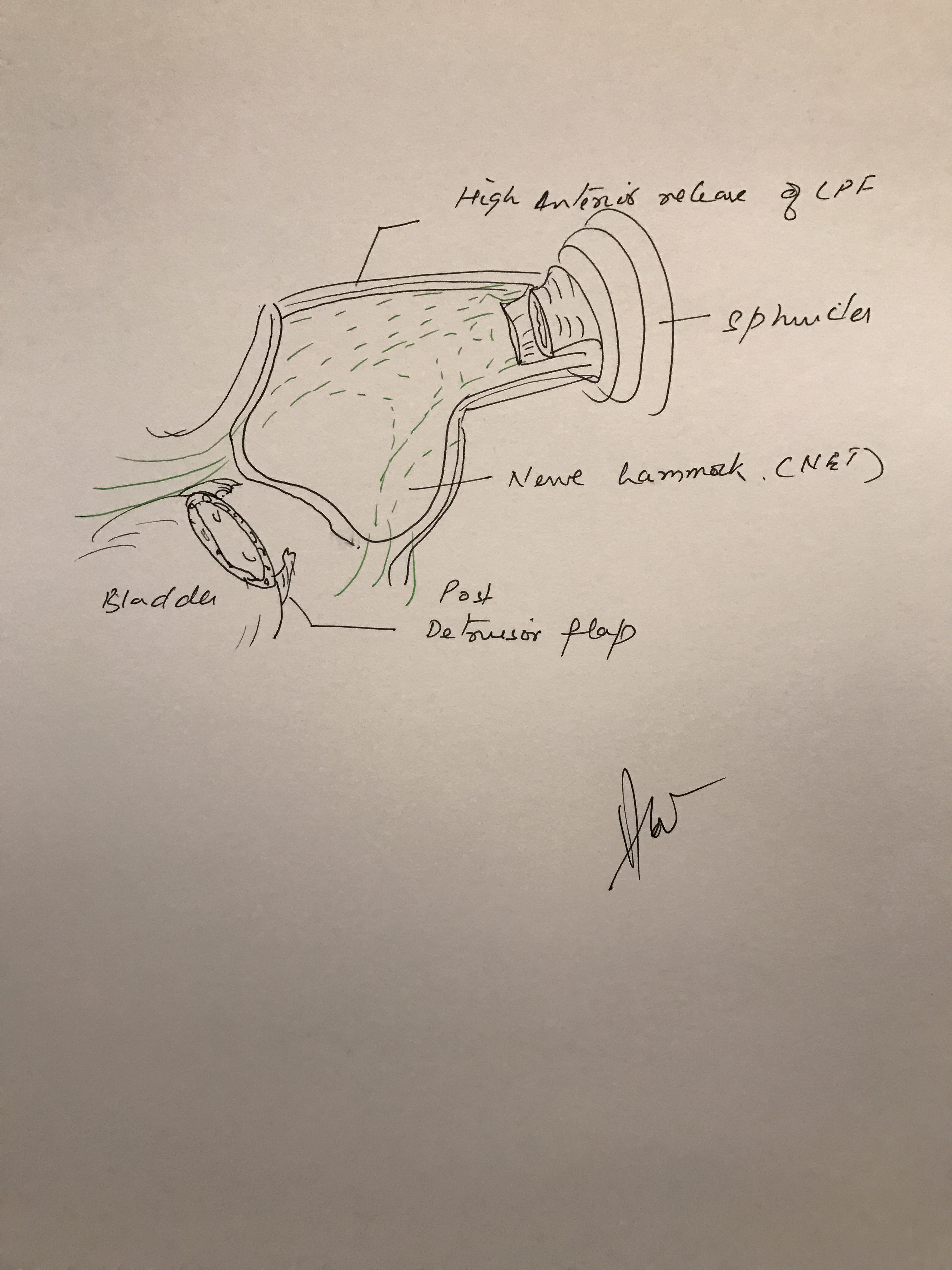 The Prostate – DRAW